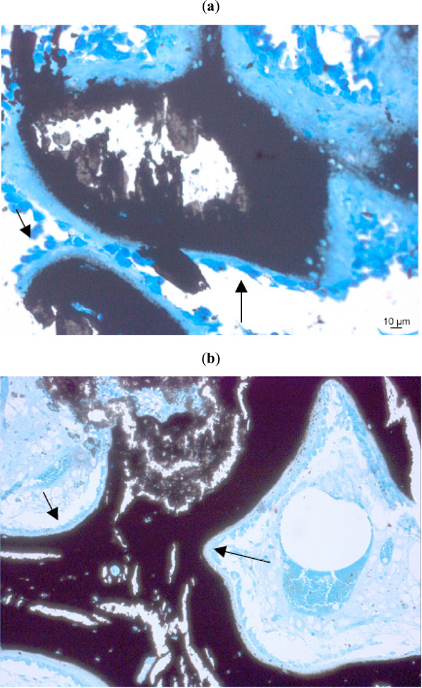 Biocompatibility Issues with Modern Implants in Bone - A Review for ...
